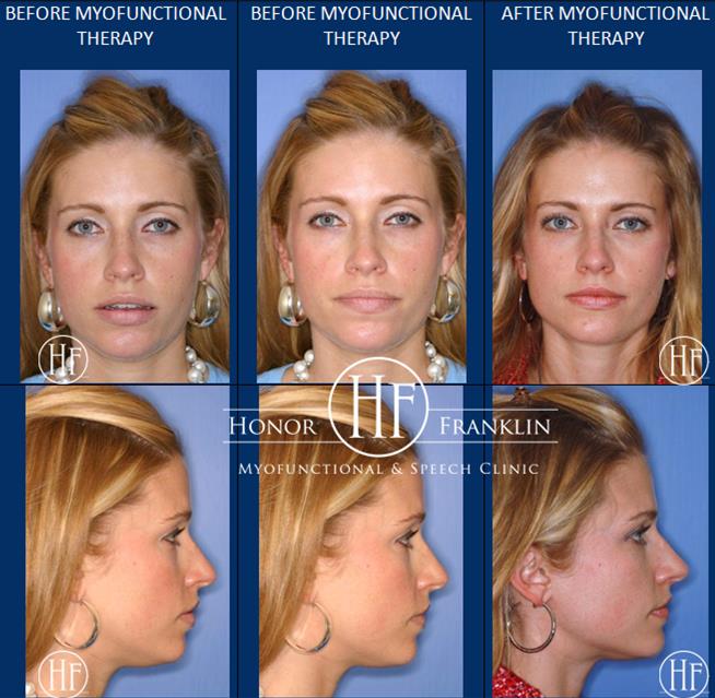 SHAY FACE - Honor Franklin